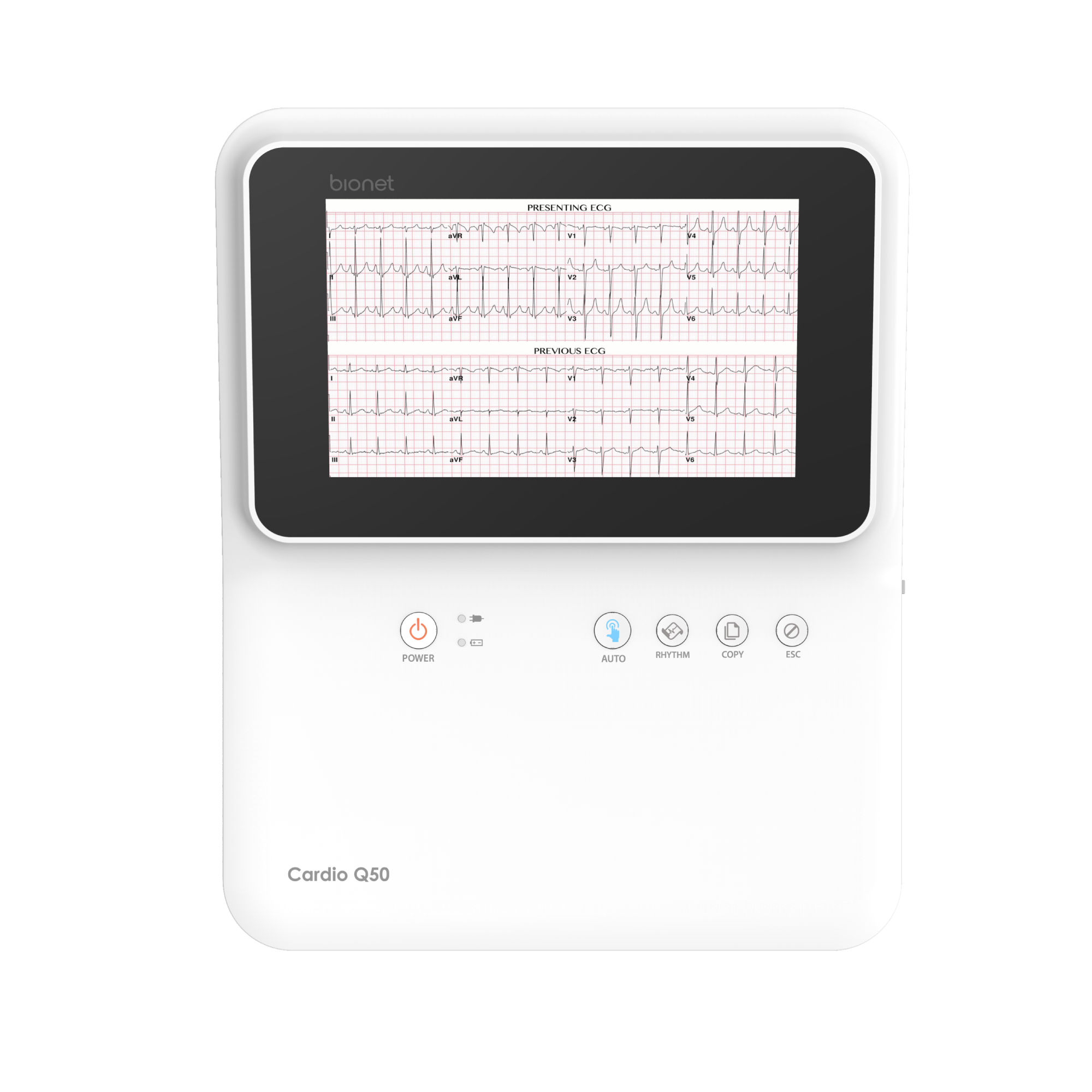 Cardio Q50 - Interpretive 12 Channel Resting Electrocardiogram (ECG ...